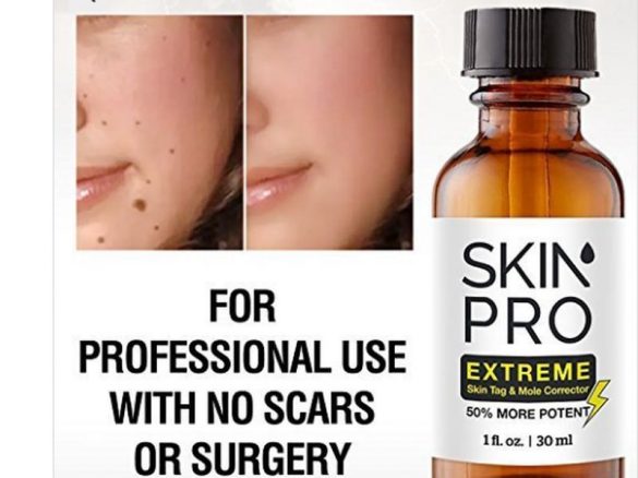Review: SkinPro EXTREME Skin Tag Remover and Mole Corrector - DIY ...